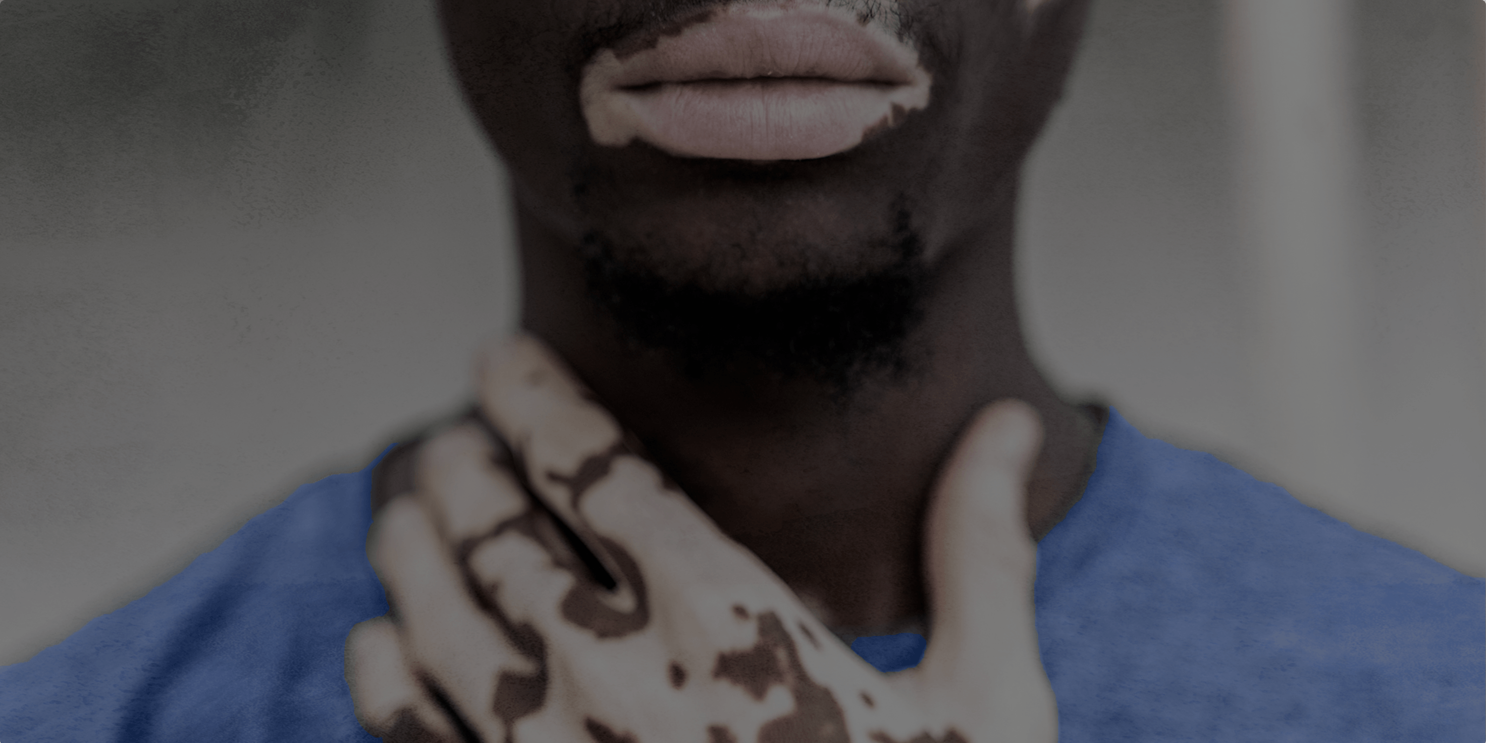 Equity in dermatology: Visual representation of darker skin is key