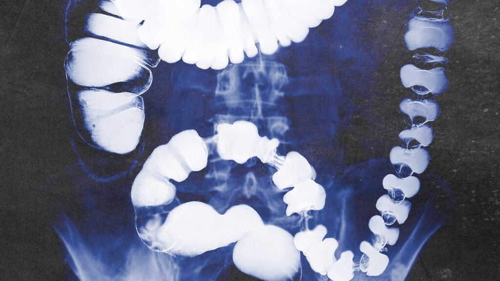 Transverse colon: Function, pain, diagram, and more