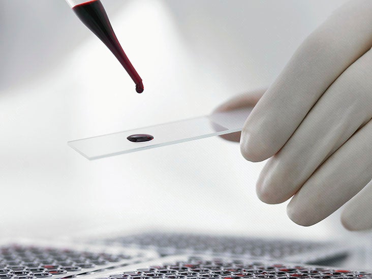 Hepatitis C, B, and A testing: Panel, results, and more