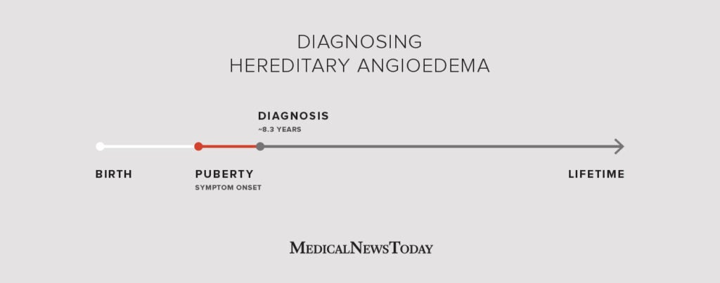 Hereditary angioedema facts and stats