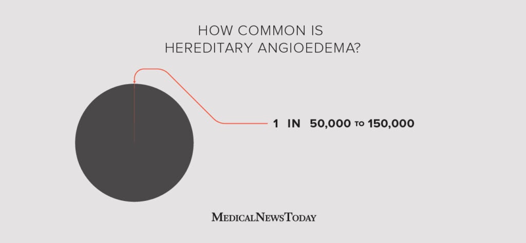 Hereditary angioedema facts and stats