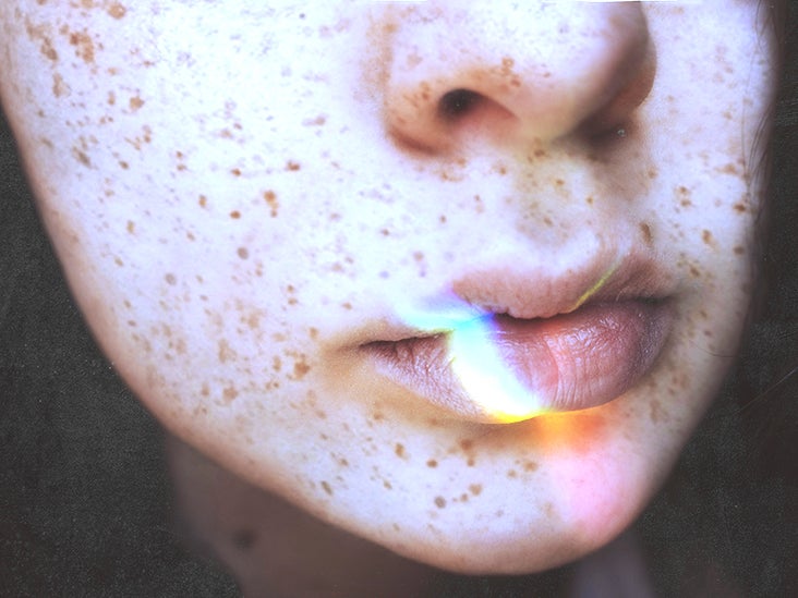 Psoriasis on lips: Symptoms, causes, treatment, and more