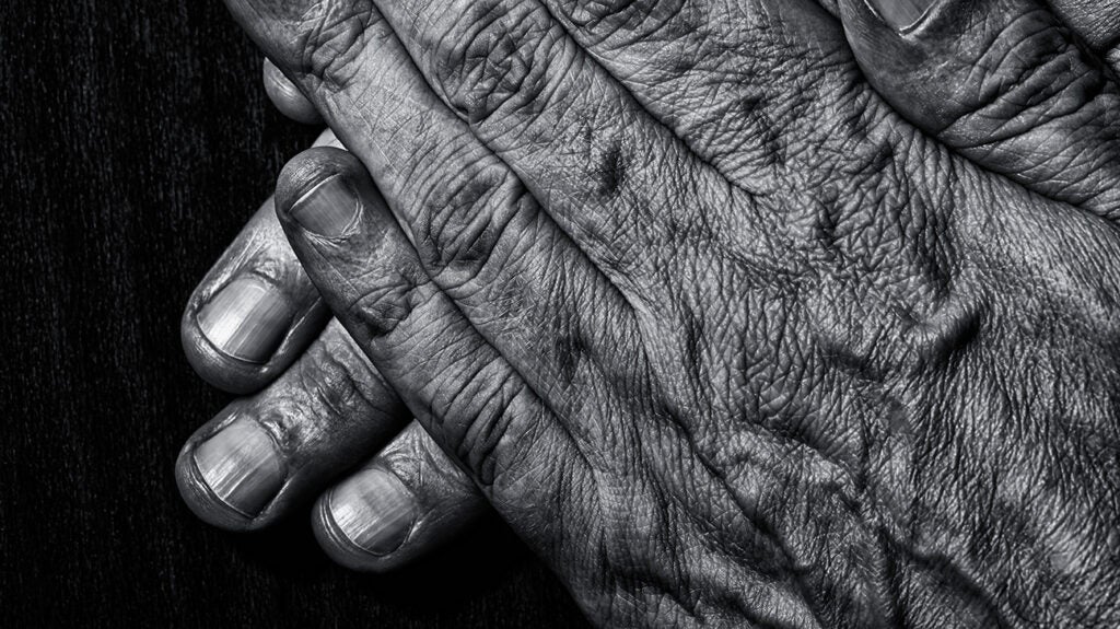 Wrinkles on black skin: Causes, treatment, and prevention