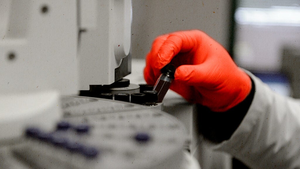 Chronic myeloid leukemia pathology: Test results and more