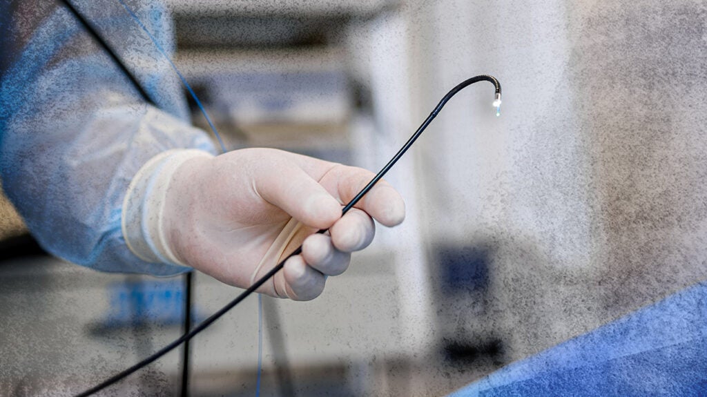 Ulcerative colitis endoscopy: What is it and more