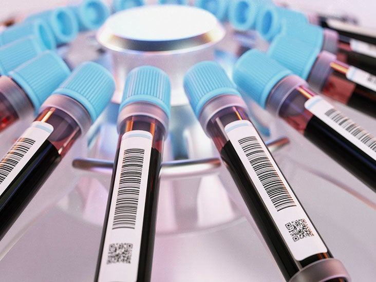 What is plasma? Function, uses, and donations