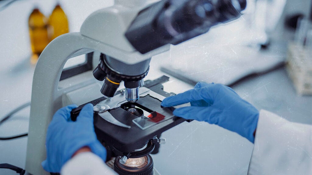 Indolent chronic lymphocytic leukemia: What to know