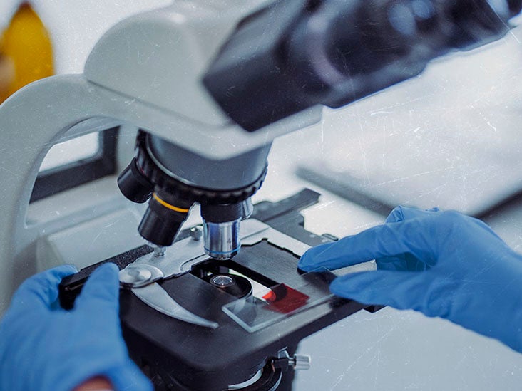 Indolent chronic lymphocytic leukemia: What to know
