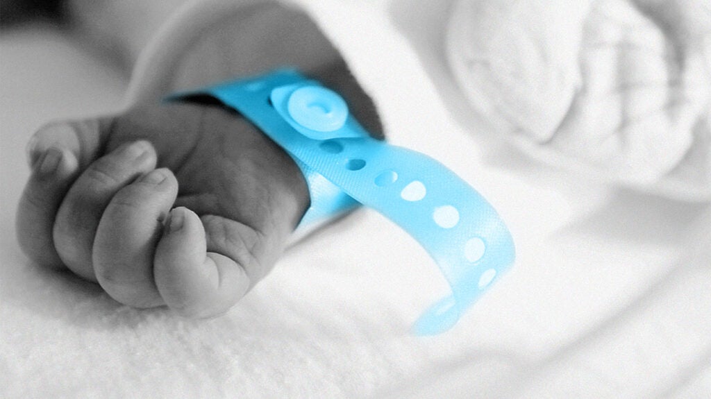 Dravet syndrome: Symptoms, treatment, prognosis, and more