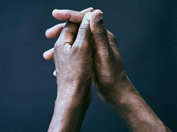 Rheumatoid arthritis in hands: Stage 1, progression, and more