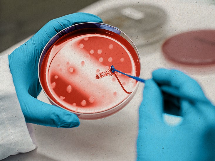 Can stem cell therapy treat non-small cell lung cancer?