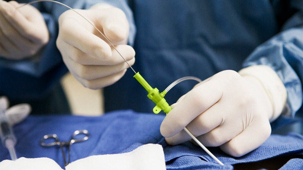 Cardiac catheterization: Definition, benefits, risks, and more