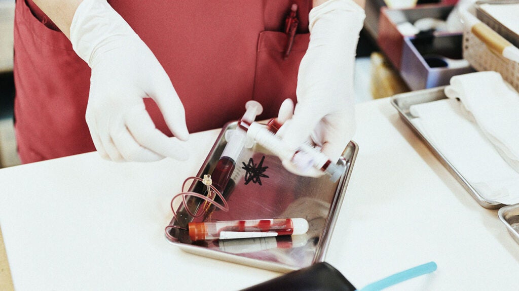 Diagnostic criteria for chronic myeloid leukemia