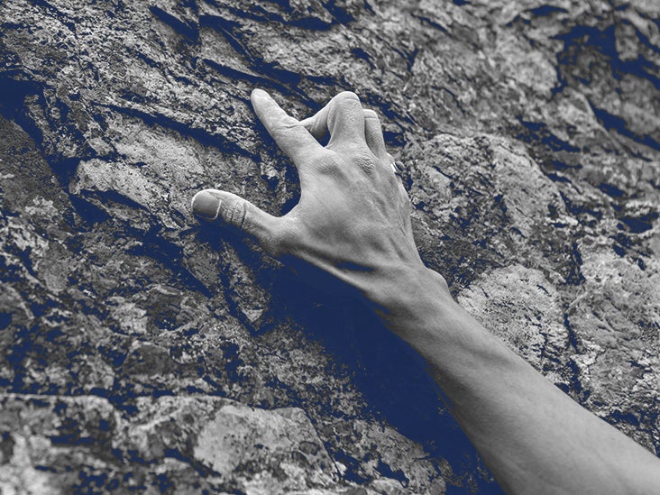 Erosive osteoarthritis: Symptoms, causes, treatments