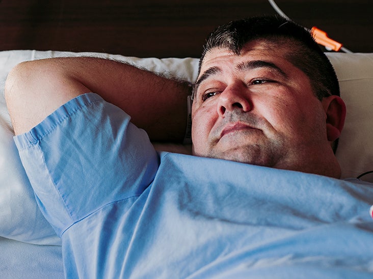 What is vertical sleeve gastrectomy (VSG) surgery?