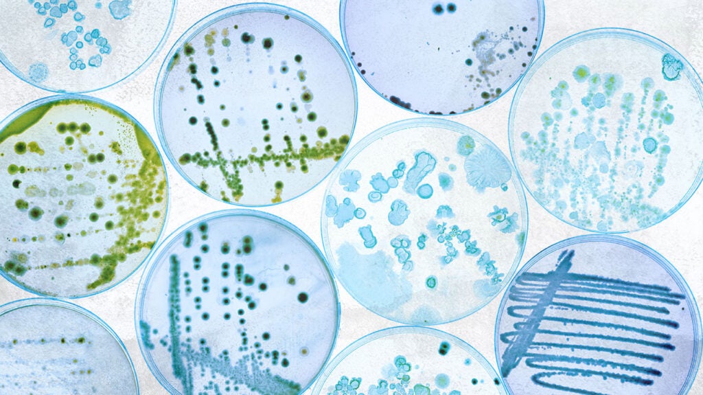 Marginal zone lymphoma: Types, treatment, outlook, and more