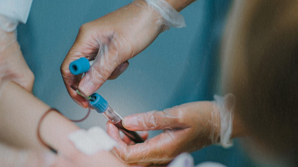 AML types: Classification and identification