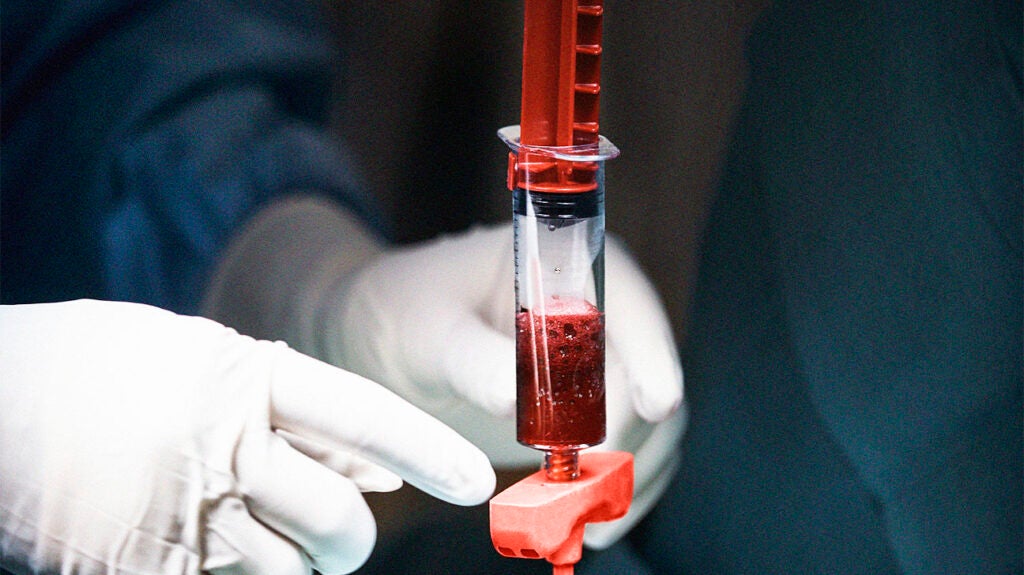 Stem cell therapy for multiple sclerosis: Explanation and safety