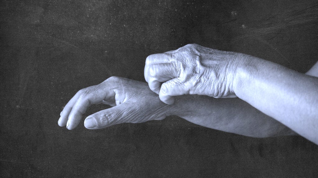 Scabies: Pictures, causes, treatment, and more