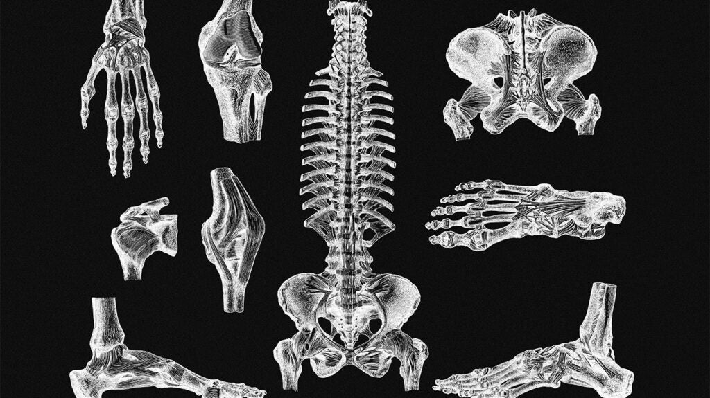 Psoriatic arthritis and enthesitis: Symptoms explained