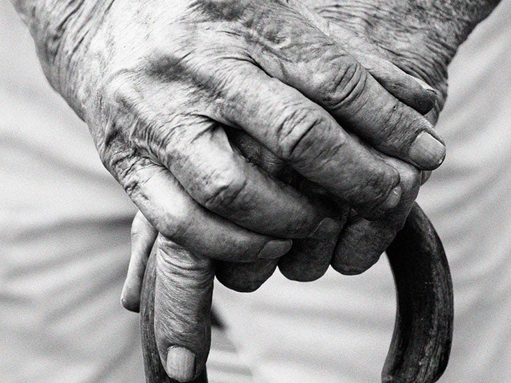 Gout: Complications and long-term management