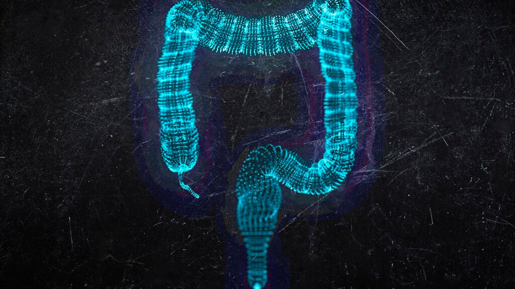 What is colitis? Types, symptoms, and treatment