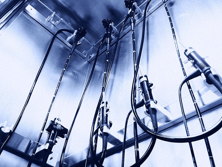 How painful is a colonoscopy?