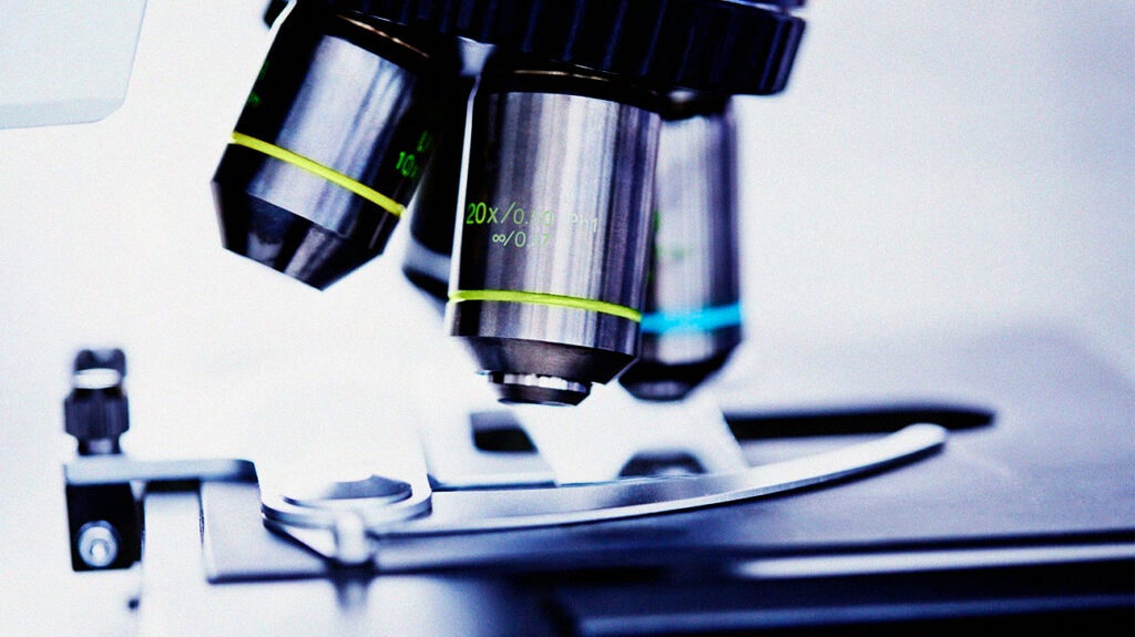 CLL and SLL: Differences and overlap explained
