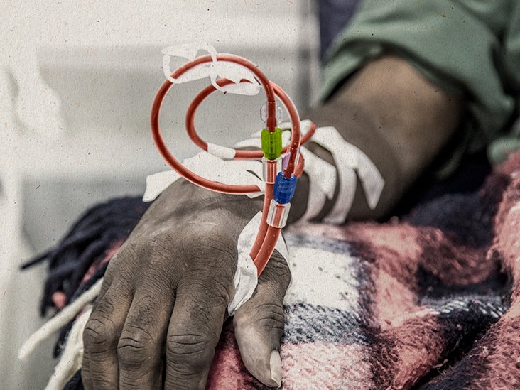 When COPD leads to kidney dialysis