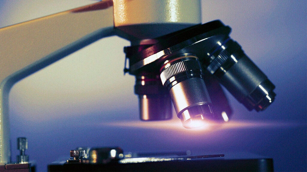 What is squamous non-small cell lung cancer?