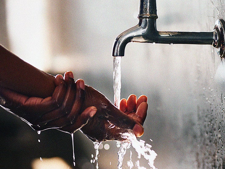 What are the causes of swollen hands?