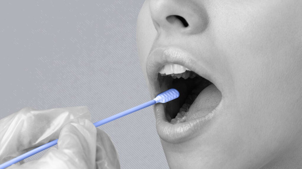 4 cheap genetic testing kits