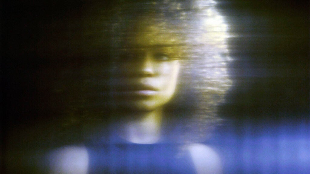 Refractory migraine: Definition, symptoms, and treatment