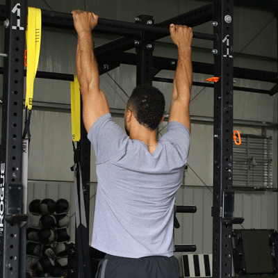 Bulging disk in back: What is it, pictures, symptoms, and treatment