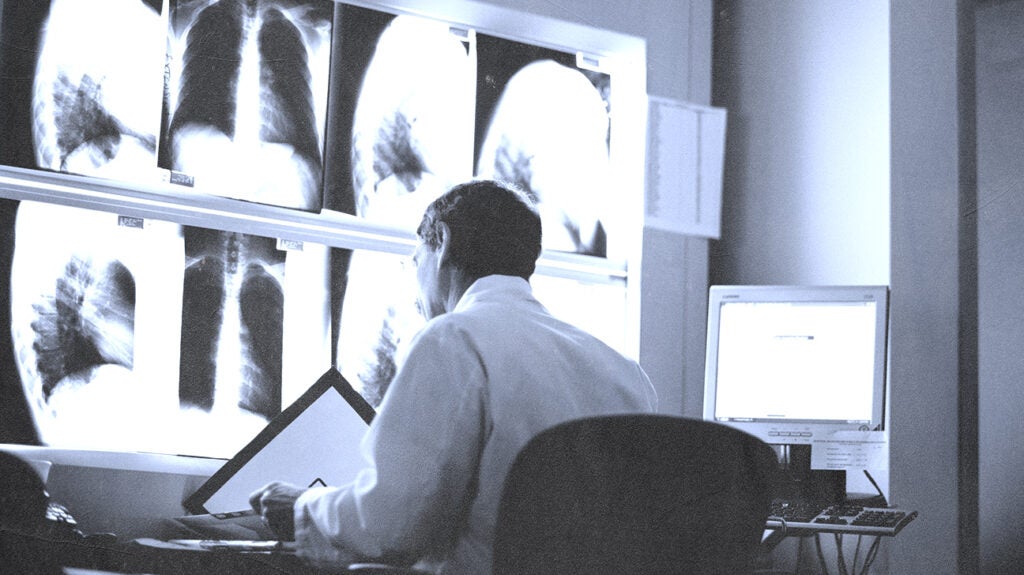 How to detect lung cancer: CT scan, tests, and more