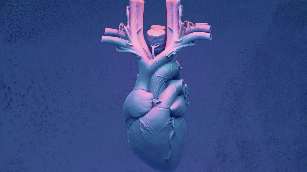 Cardiac Arrest Vs Heart Attack Differences Explained cardiac-arrest-vs-heart-attack-differences-explained