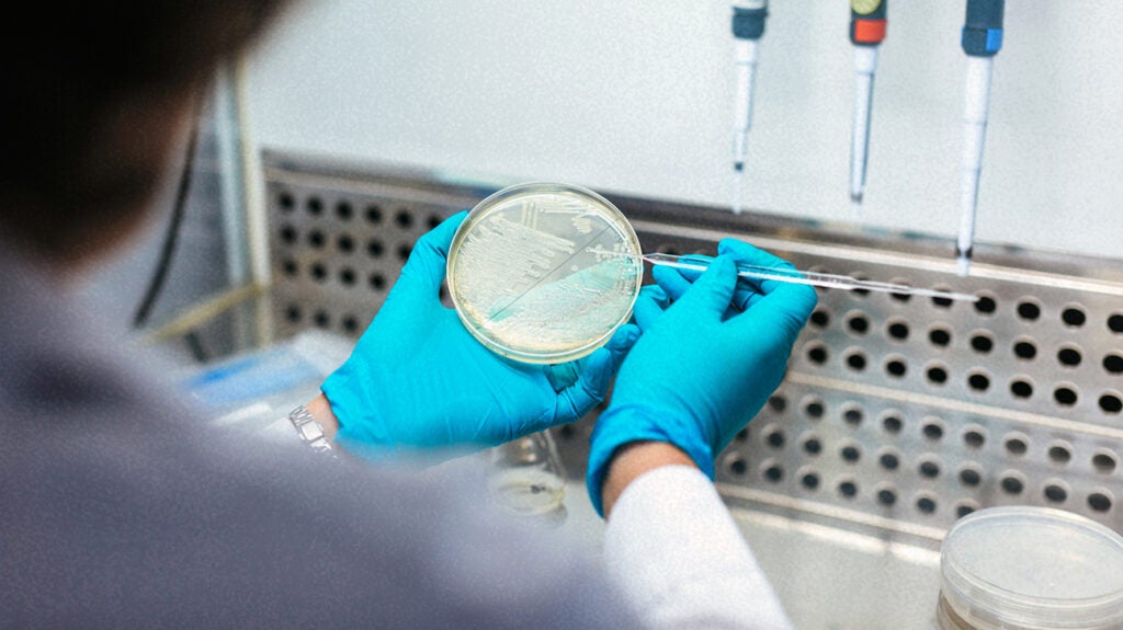 The microbiome: What about archaea?