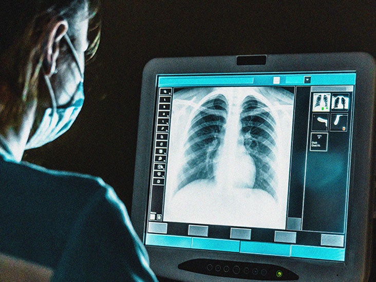 COPD and pneumonia: What is the connection?