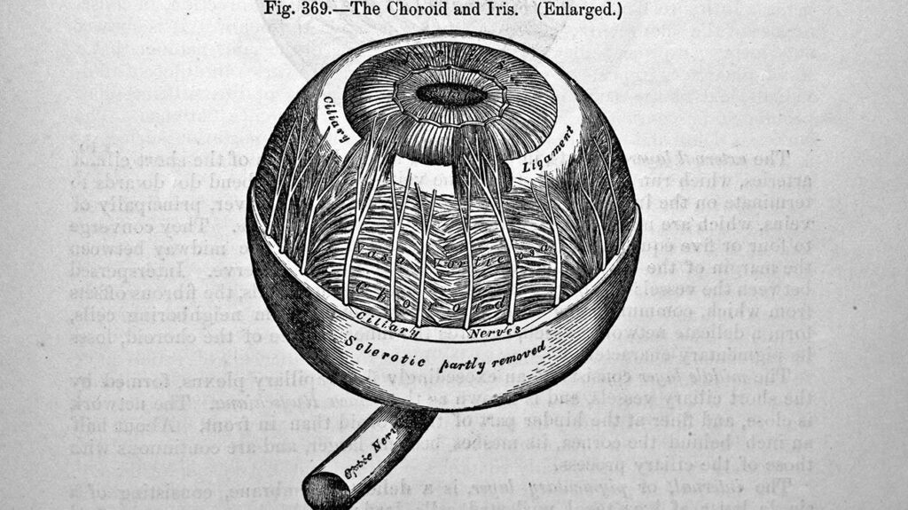 Neuromyelitis optica (NMO): Symptoms, treatment, and more