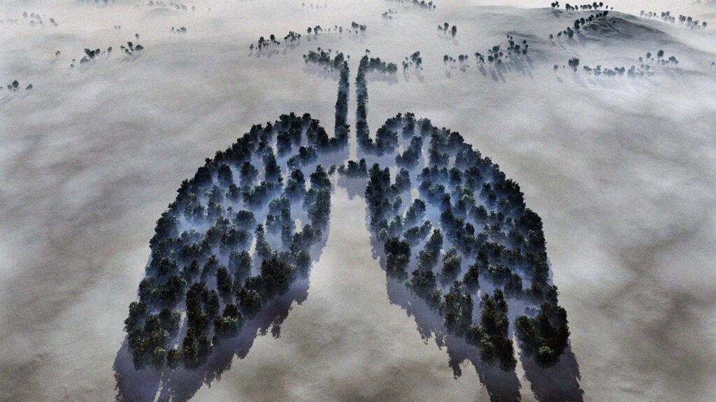 Pulmonary interstitial emphysema: Types and treatment