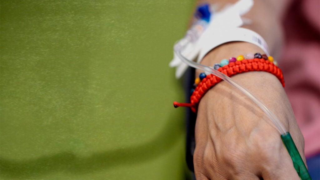 Adjuvant vs. neoadjuvant chemotherapy: What to know Adjuvant vs. neoadjuvant chemotherapy: What to know