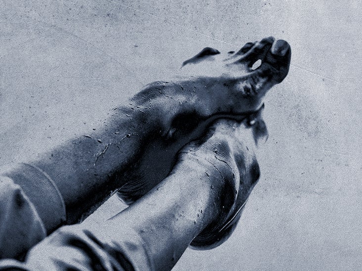 Rheumatoid arthritis vasculitis: Symptoms and treatment