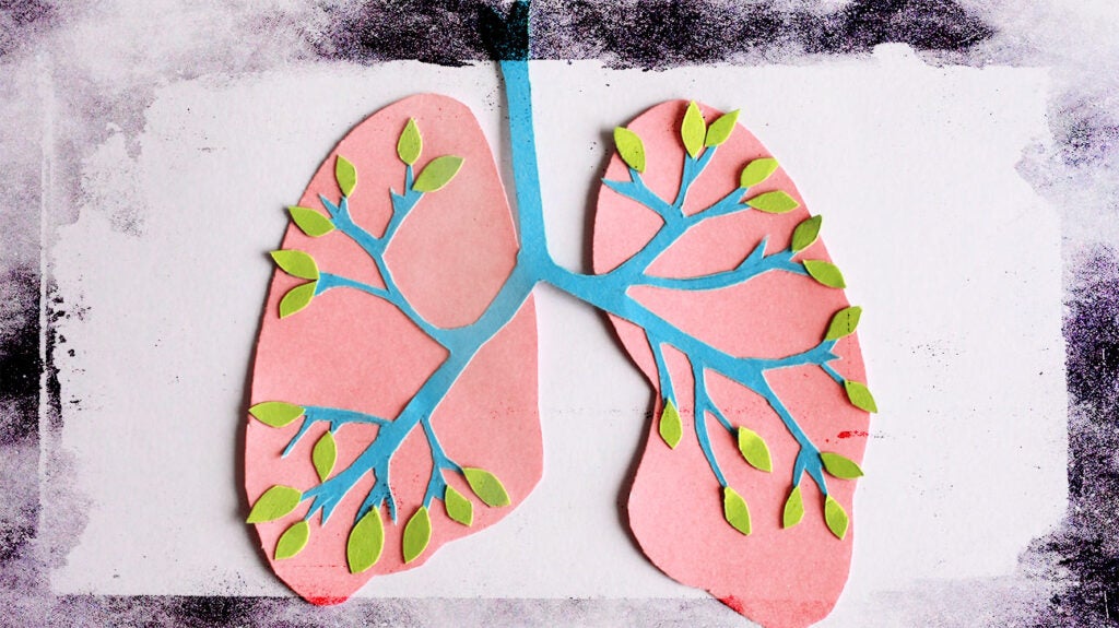 Advanced emphysema: Stage 4 symptoms and treatment