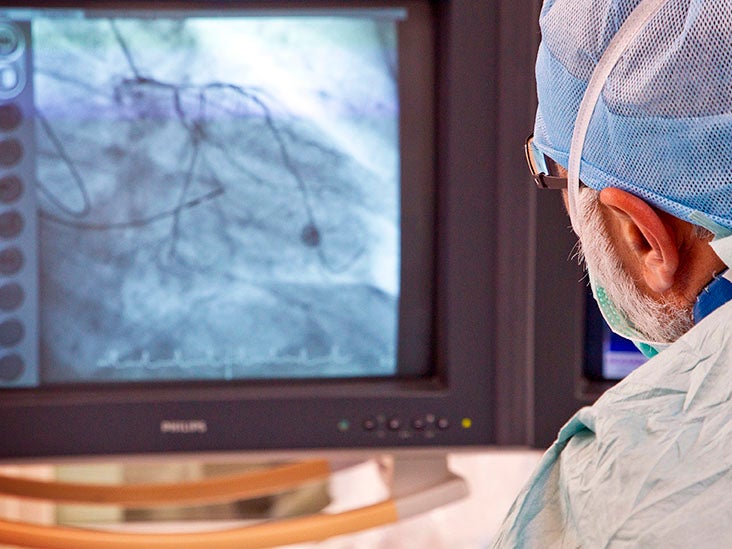 Coronary artery dissection: Symptoms, causes, and treatment