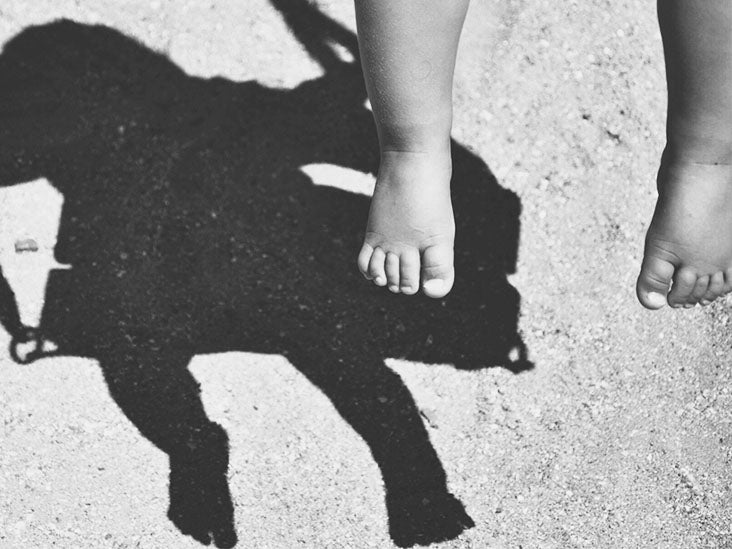 Bow legs: Definition, causes, treatment, more