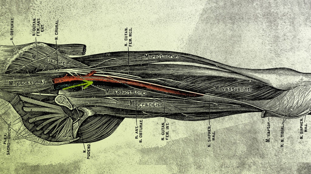 Femoral neuropathy: Causes, diagnosis, treatment, and exercises