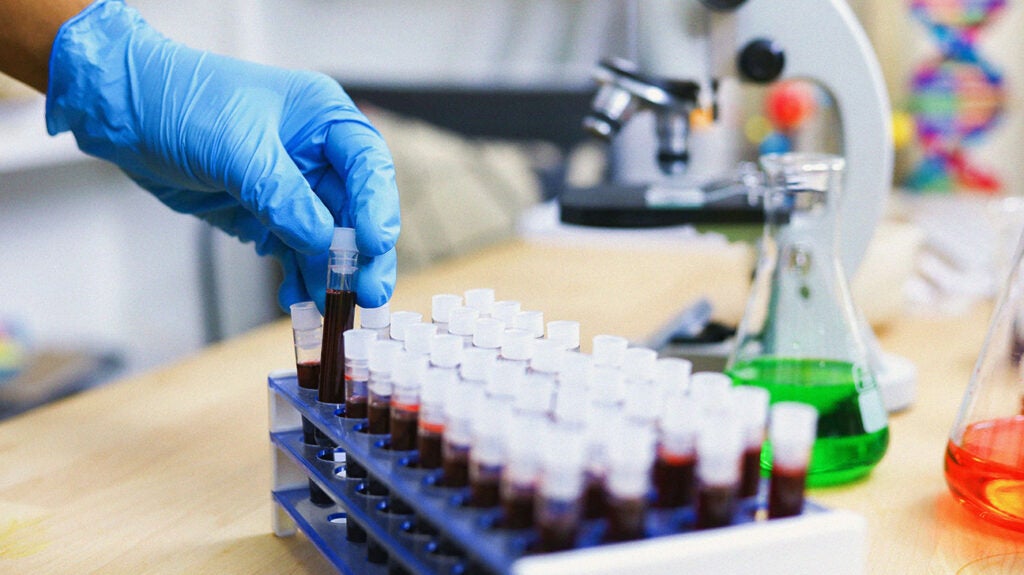 What to know about hepatitis B surface antibodies