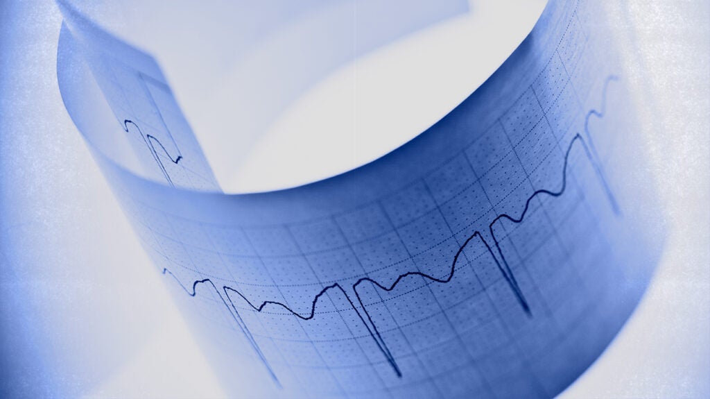 The 5 classes of pulmonary hypertension