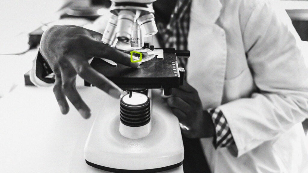 HRD testing ovarian cancer: What does a positive result mean?