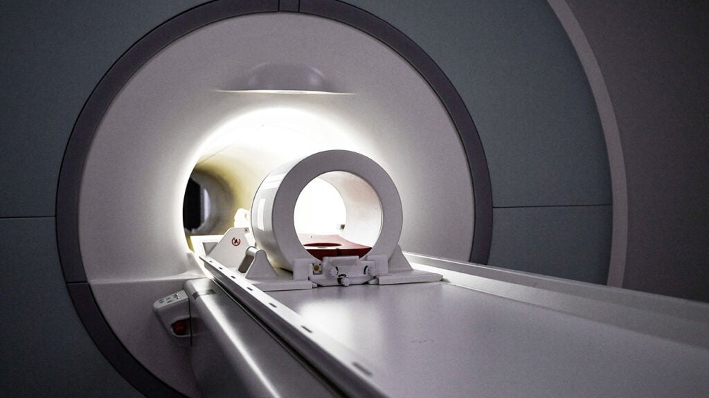 Cerebral venous thrombosis: Causes, treatment, and diagnosis